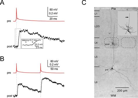 Electrophysiological And Morphological Characterization Of Neuronal Microcircuits In Acute Brain