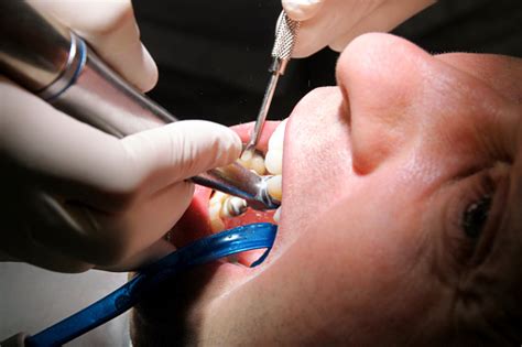 치과 치아 연마입니다 치아 청소 치과 위생입니다 그의 치과 진료소 및 사무실에서 직장에서 치과 도구 거울 부드러운 치과 브러시와