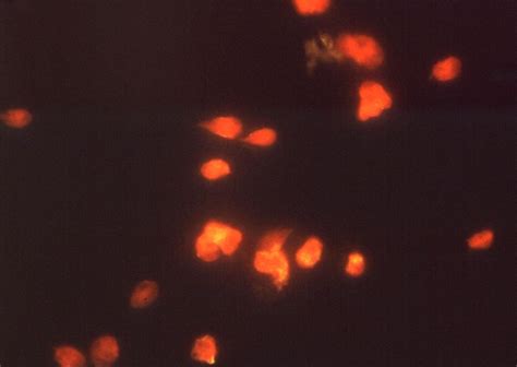 Free Picture Giardia Lamblia Parasites Immunofluorescence Test