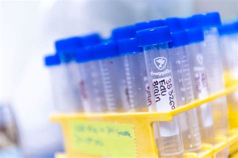 LSI Researchers Awarded Funding Through Spring CIHR Project Grant Competition Life