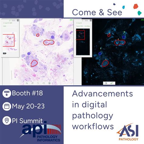 Applied Spectral Imaging Asi On Linkedin Pathologyinformatics