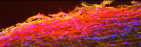 Rna “specialists” Activate Nerve Regeneration