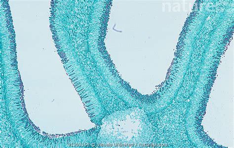 Morchella Microscope