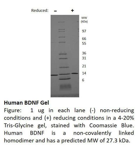 Human Brain Derived Neurotrophic Factor Recombinant Protein