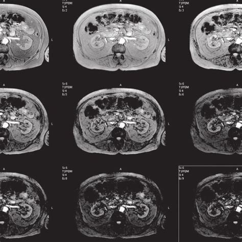 A An Example Of A Sequence Of Echo Image Download Scientific Diagram