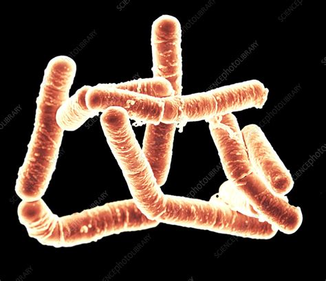 Bacillus Subtilis Sem Stock Image C058 4765 Science Photo Library