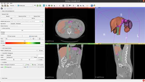 radiology app nvidia docs
