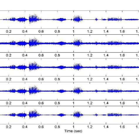 segmental snr of four linearly spaced frequency bands of speech