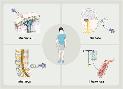Function Of Intrathecal Injection At Robert Parsley Blog
