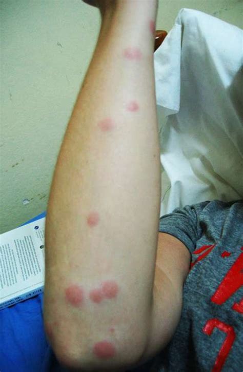 Can Flying Termites Harm Humans