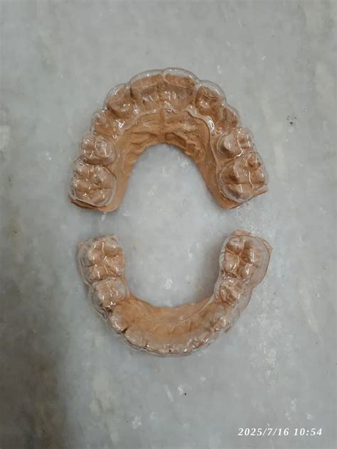 Essix Retainer Upper And Lower Removable Retainers At ₹ 999 Piece In Patna