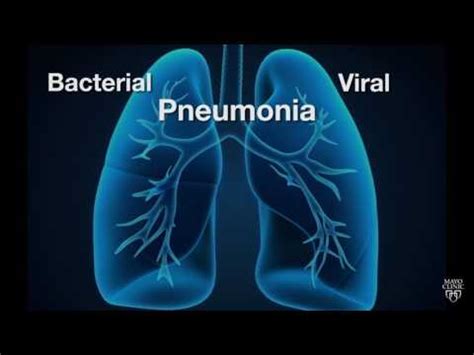 What Is The Difference Between Pneumonia And Pneumonia Health Articles 2024