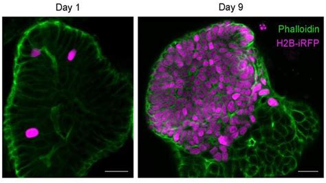 Organoid Study Reveals How Tuft Cells Act As Reverse Stem Cells After
