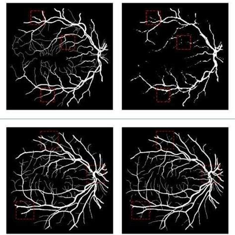 The Illustrations Of Comparisons Between PSP And ASPP Modules There Download Scientific