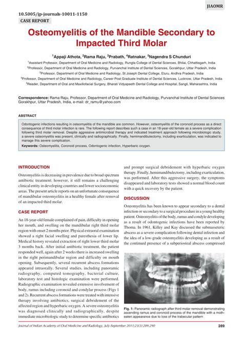 Pdf Osteomyelitis Of The Mandible Secondary To Impacted Third Molar