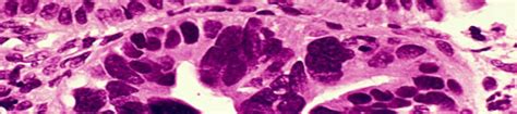 Beta Thalassemia Treatment Of Beta Thalassemia Types Diseases