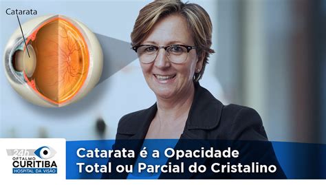 a catarata consiste na opacidade parcial ou total do cristalino