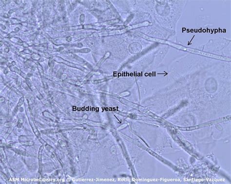 Round Yeast Gram Positive With Stippling Budding Yeast Pseudohyphae