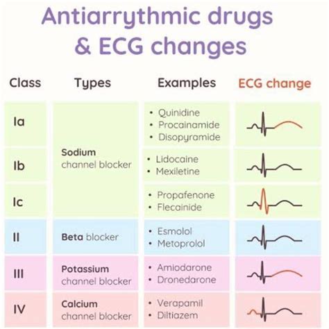 Medical Crack The Code Antiarrhythmic Drugs And Their Ecg Fingerprints Facebook