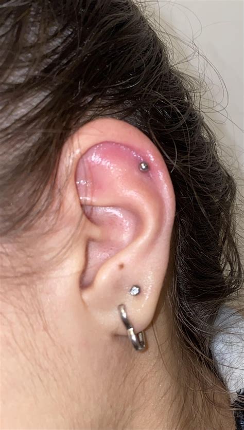 Is My Helix Infected Or Just Irritated R Piercing