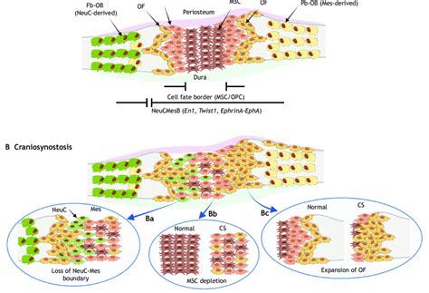 Suture Morphology And Pathogenesis Of Craniosynostosis A The Frontal Download Scientific