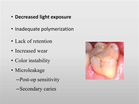 Light Curing Units Pptx