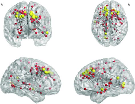 Network Based Statistics Nbs On Absolute Functional Connectivity Download Scientific Diagram
