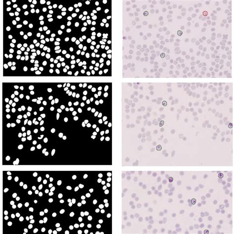 The Result Classification Of Malaria Parasites Image Red Contours Show Download Scientific