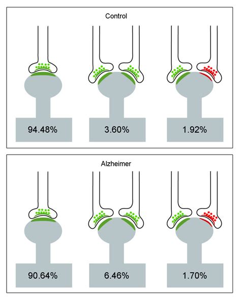 Schematic Representation Of Single And Multiple Synapses On Dendritic