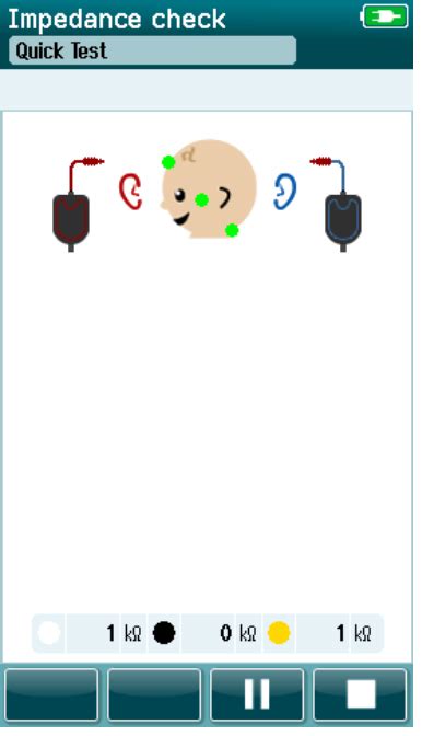 Sera™ How To Do Automated Abr Interacoustics