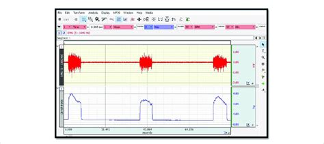 Emg Measurement Graph Download Scientific Diagram