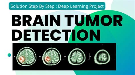 Brain Tumour Detection With Deep Learning In Python Deep Learning Project Help