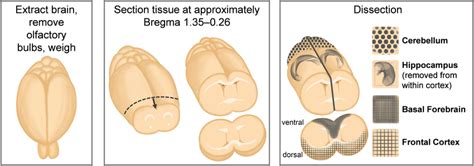 Brain Region Dissection Protocol Schematic Of Tissue Extraction Download Scientific Diagram