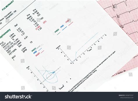 Close Pulmonary Report Showing Spirometry Graph Stock Photo Shutterstock