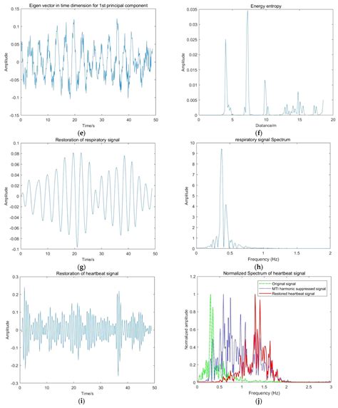 Sensors Free Full Text A Vital Signs Fast Detection And Extraction