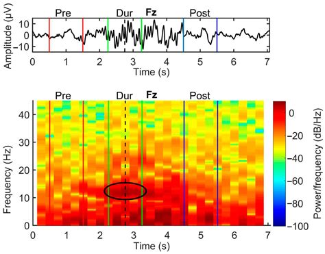 Sleep Spindle Eeg Frequency