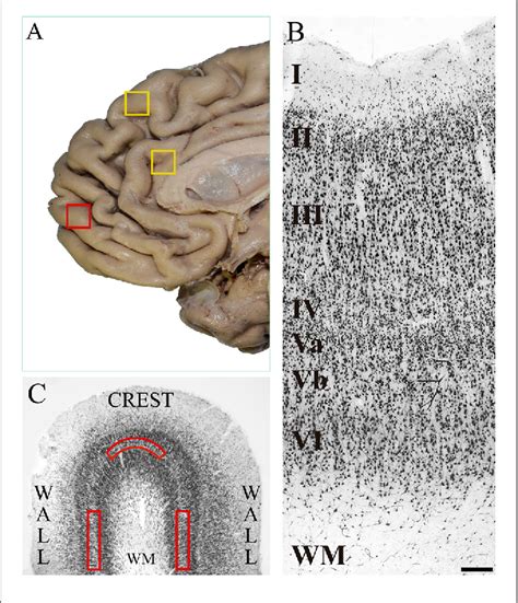 Figure 1 From Von Economo Neurons In The Human Medial Frontopolar