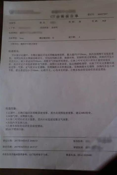 案例——肺癌腦轉移患者經過中醫治療，病灶基本消失 每日頭條