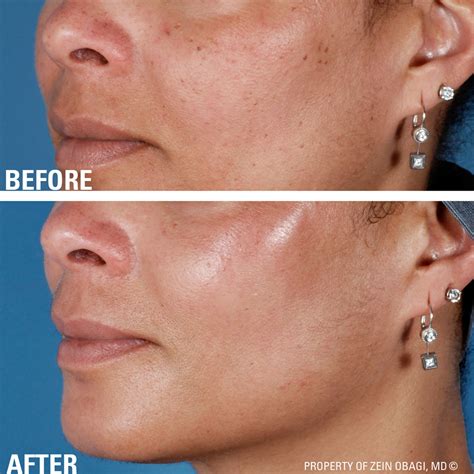 Before And After The Skin Health Doctor