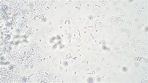 Episome Biotechnologies On Linkedin Episodesfromepisode