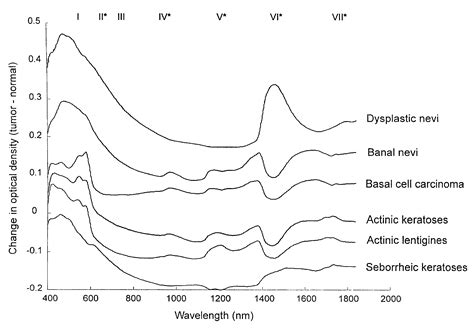 Lesion Types Patented Technology Retrieval Search Results Eureka Patsnap