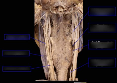 Head And Neck Lab Neck Diagram Quizlet