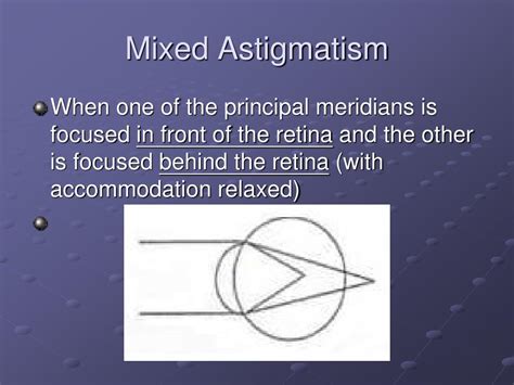 Ppt Astigmatism Powerpoint Presentation Id1223322