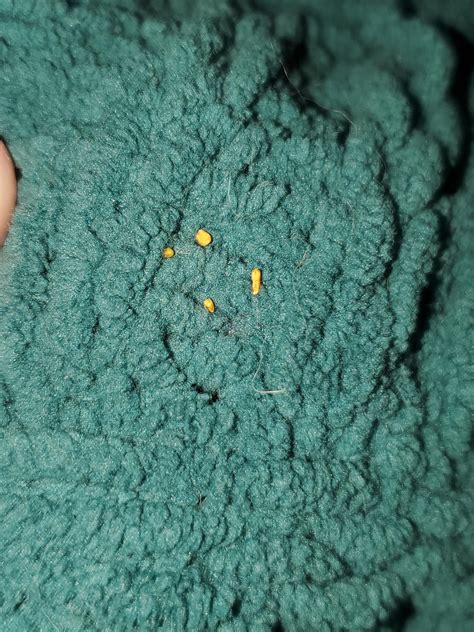 Are These Tapeworm Eggs Or Am I Paranoid R Cats