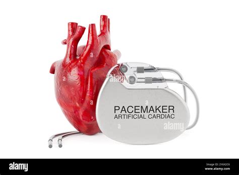 Implantable Artificial Cardiac Pacemaker Device With Red Human Heart On A White Background 3d