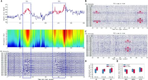 physiological dynamics associated with seizure events a top panel