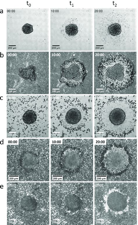 Cellular Aggregates Spreading On Substrates Coated With Light