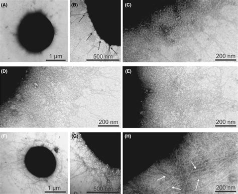 Pili On The Surface Of Synechocystis Sp Pcc 6803 Nonmotile And Motile Download Scientific