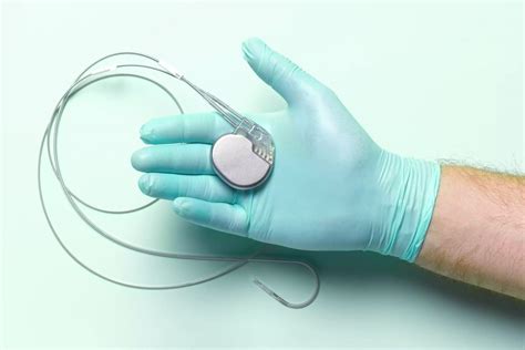 Pacemaker Defibrillator Implant