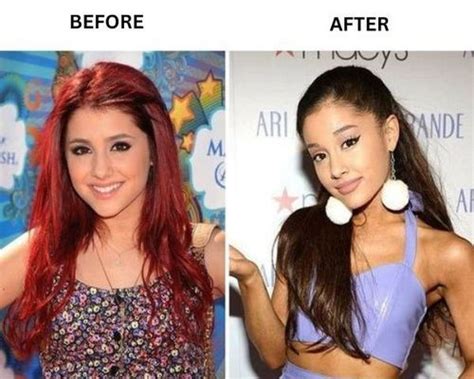 Ariana Grande Plastic Surgery All Details Revealed Fabbon